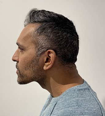 The Head Retraction: Make It Better! – Synergy Sports Medicine ...